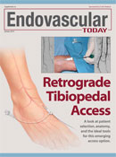 Anatomy of the Pedal Arch and Implications for Tibiopedal Access ...
