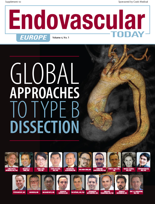 TEVAR for Chronic Type B Aortic Dissection - Endovascular Today