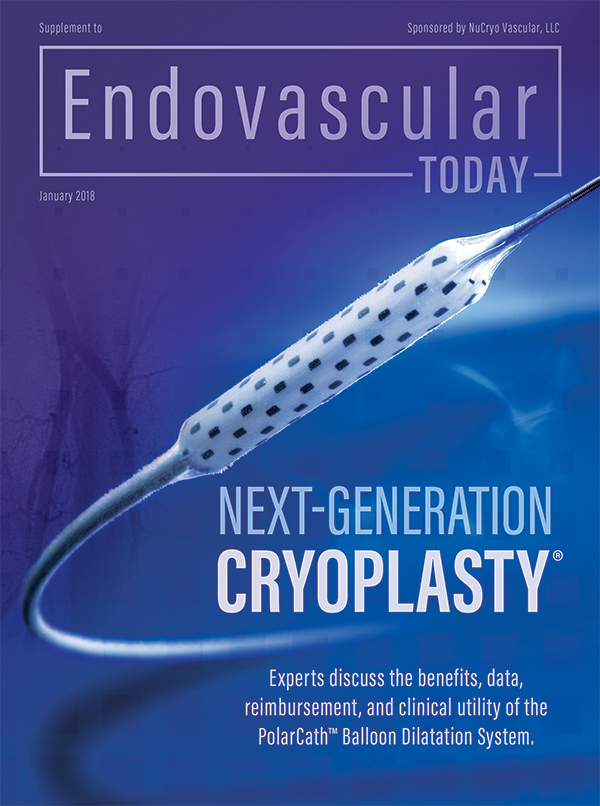 Benefits of Cryoplasty Compared to DCB - Endovascular Today