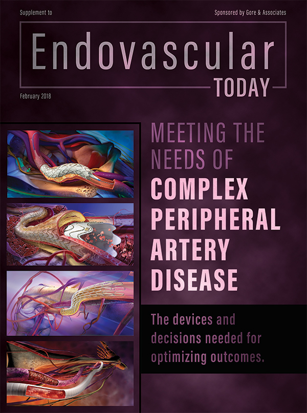 Case Report: GORE® TIGRIS® Vascular Stent Implantation in Segmental ...