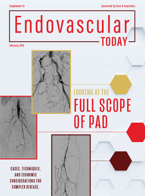 Best Practices for Lower Extremity Bypass - Endovascular Today