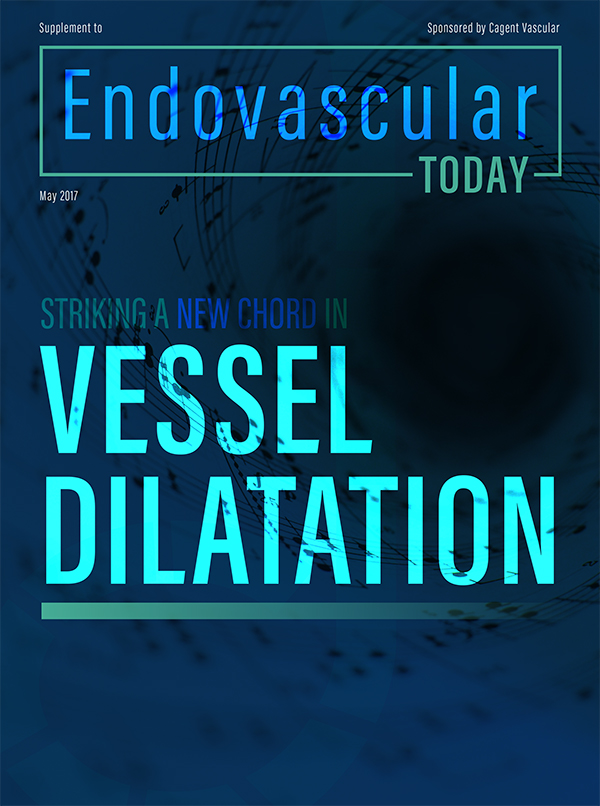 The Serranator® Alto PTA Serration Balloon Catheter - Endovascular Today