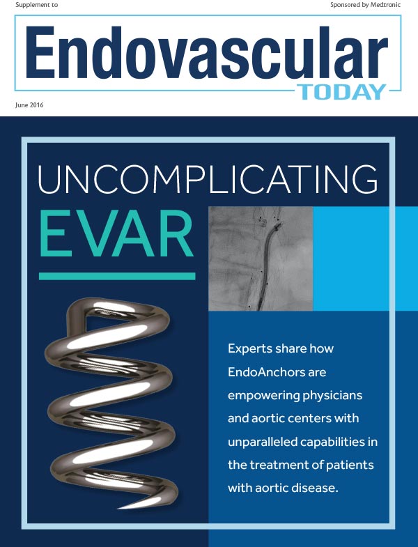 EndoAnchors Advance Treatment of Aortic Aneurysms: Experience in a ...