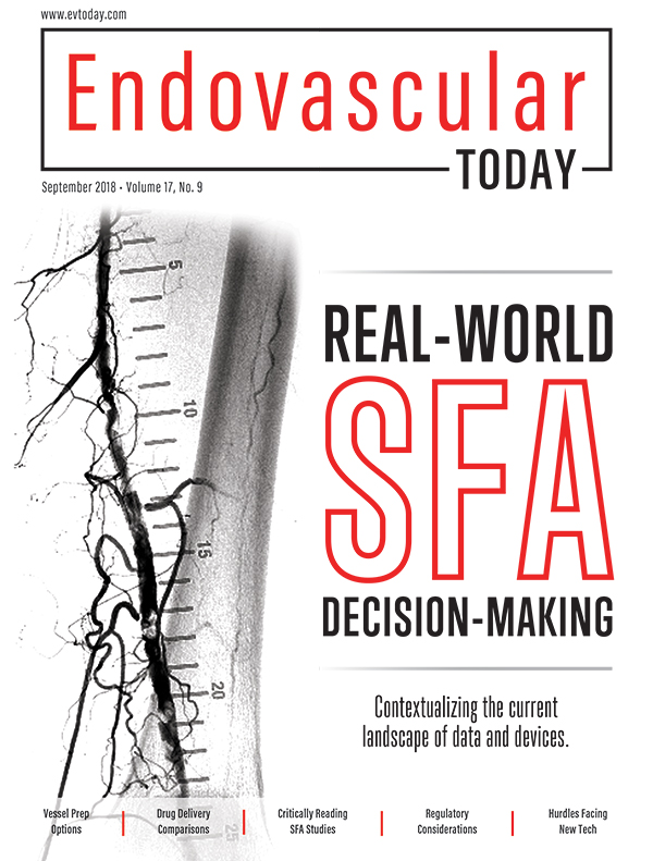 Transforming Open to Endo: Percutaneous Bypass as an Option for Long ...