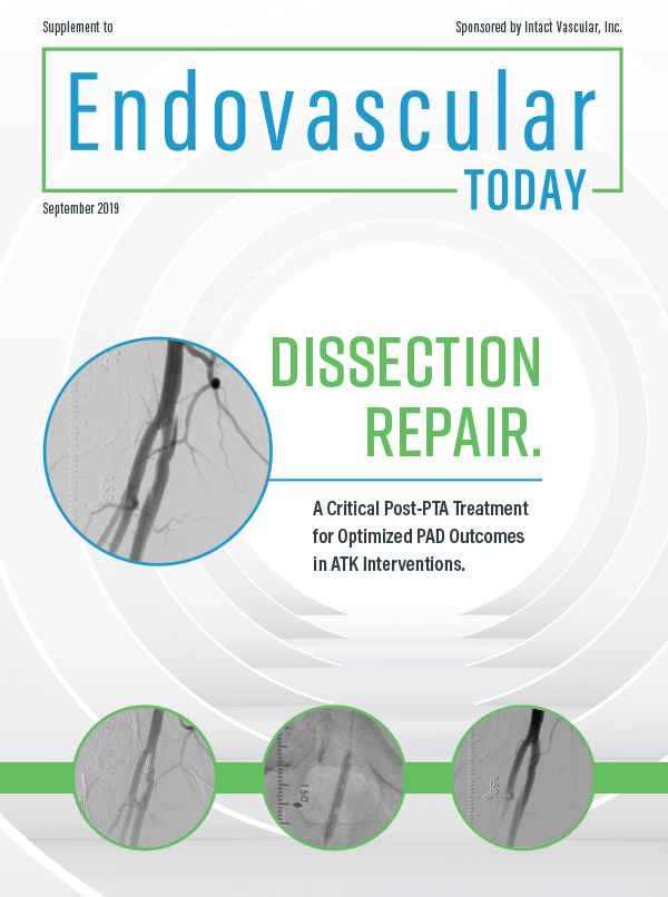 Optimized PTA With Tack Salvage Following Rendezvous Subintimal SFA CTO ...