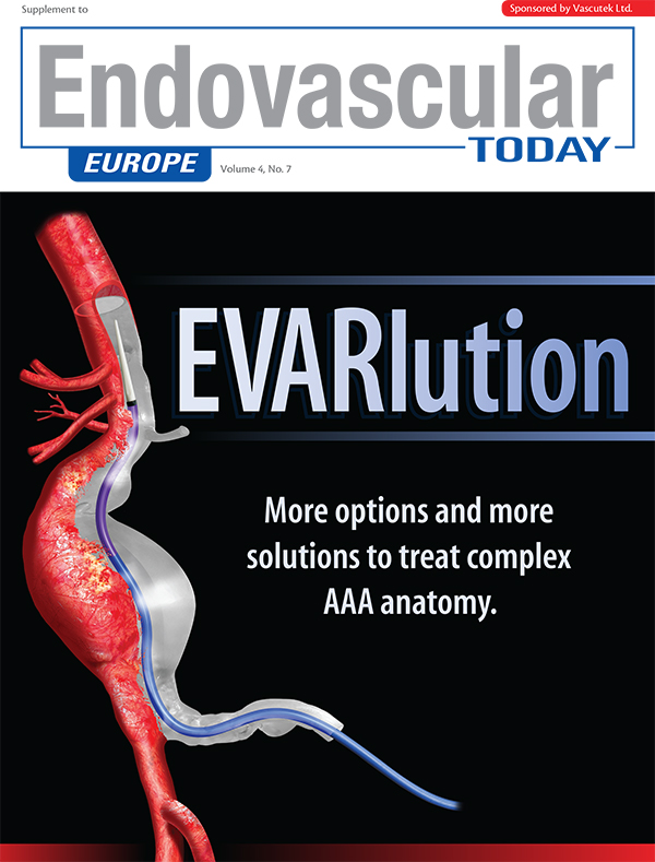 Anaconda™ AAA Stent Graft System for Challenging AAA Anatomy ...